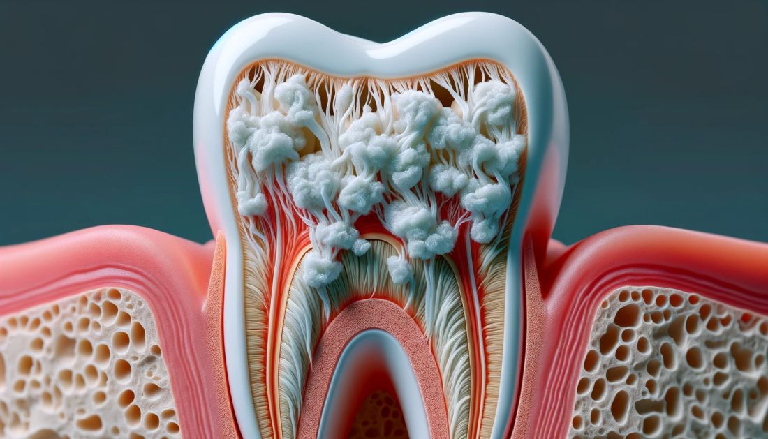 Hereditory Gingival Fibromatosis | Enhanced Dental CPD Online